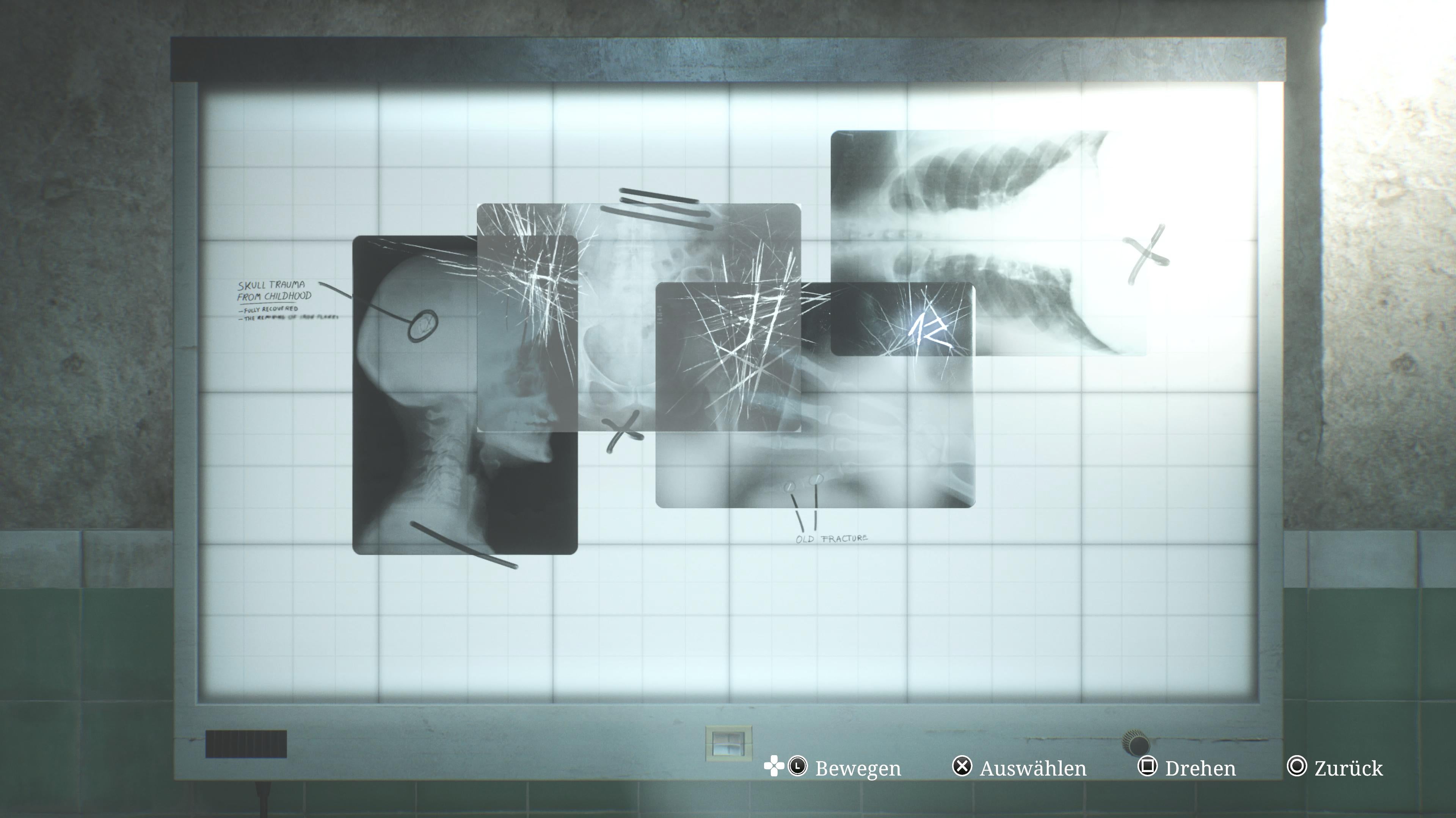 Silent Hill 2 Remake - Krankenhaus 7: Röntgen-Bilder, Code ...